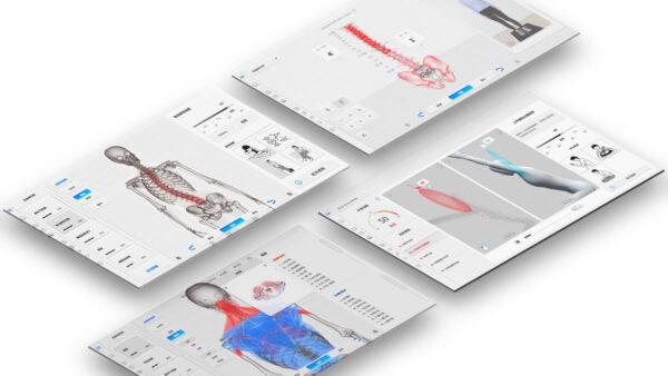 AI-powered 3D posture analyser | Back Pain and Posture Clinic